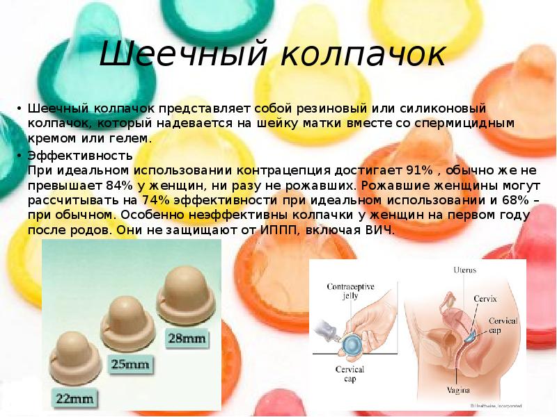 Методы контрацепции