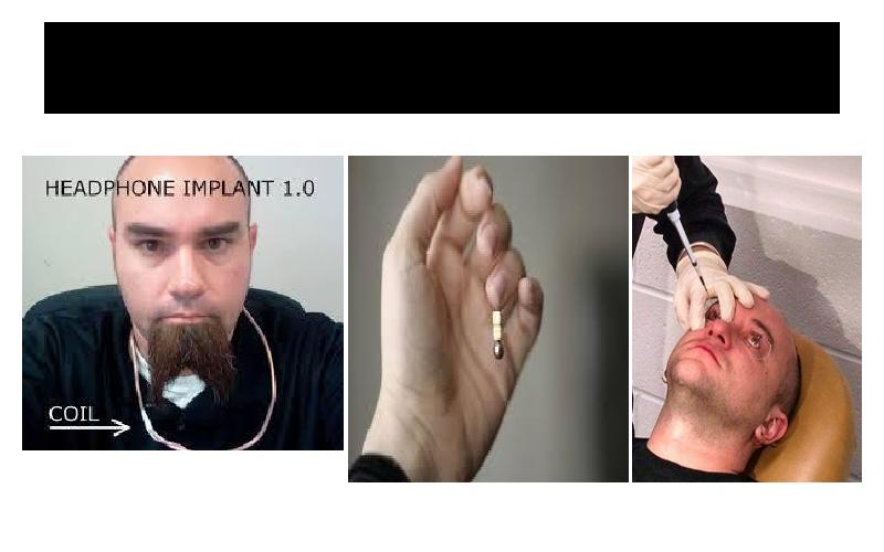 The Human Body in the IoT - презентация, доклад, проект