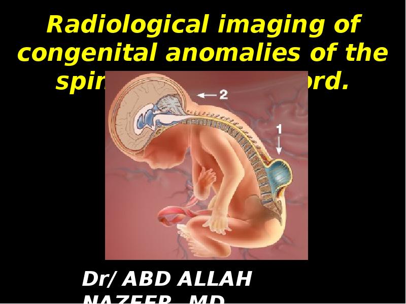 Radiological imaging of congenital anomalies of the spine and spinal cord.