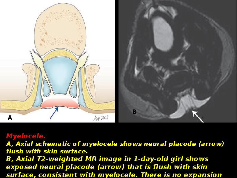 Radiological imaging of congenital anomalies of the spine and spinal cord.