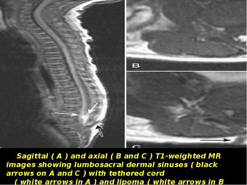 Radiological imaging of congenital anomalies of the spine and spinal cord.