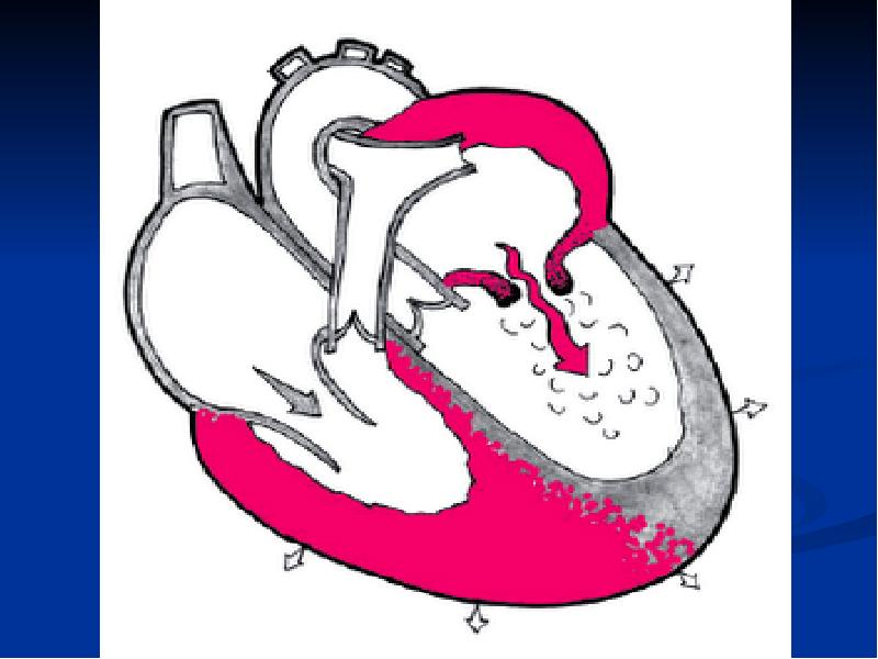 acquired heart defects