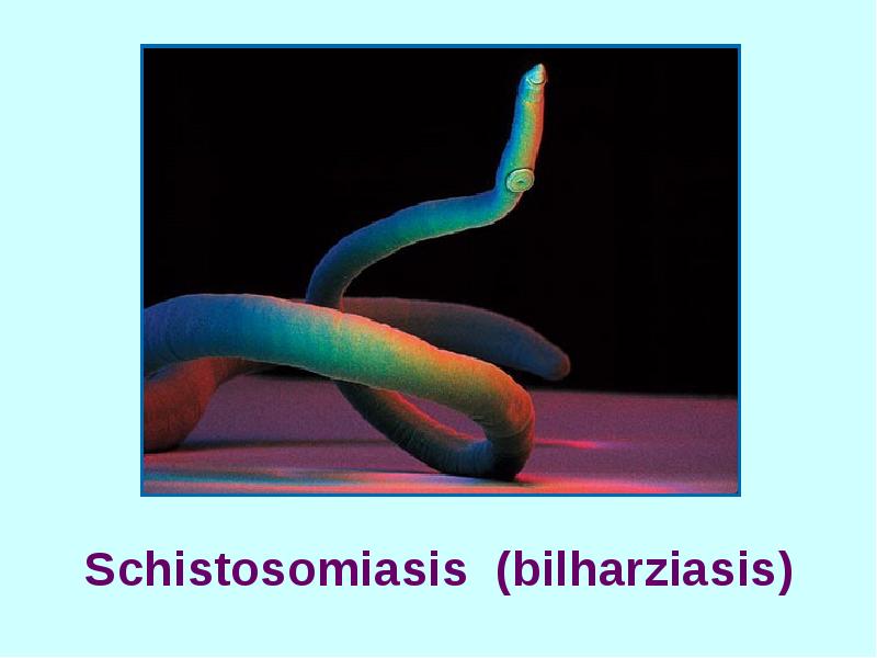 Schistosomiasis ( bilharziasis )