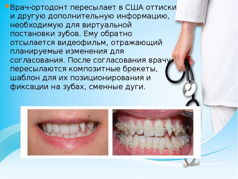 СРС на тему: Инновационные технологии в ортодонтии