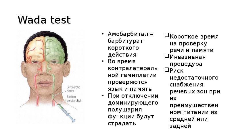 фМРТ в нейрохирургии