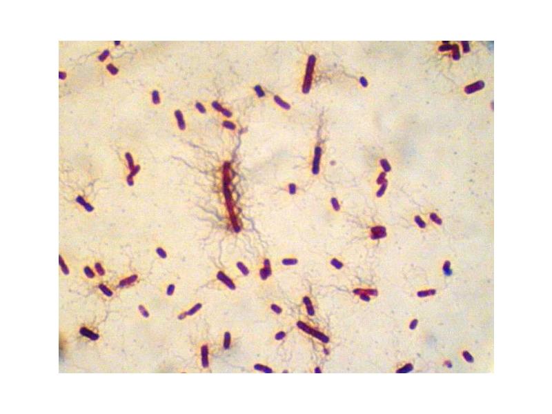 ENTERIC BACTERIAL PATHOGENS