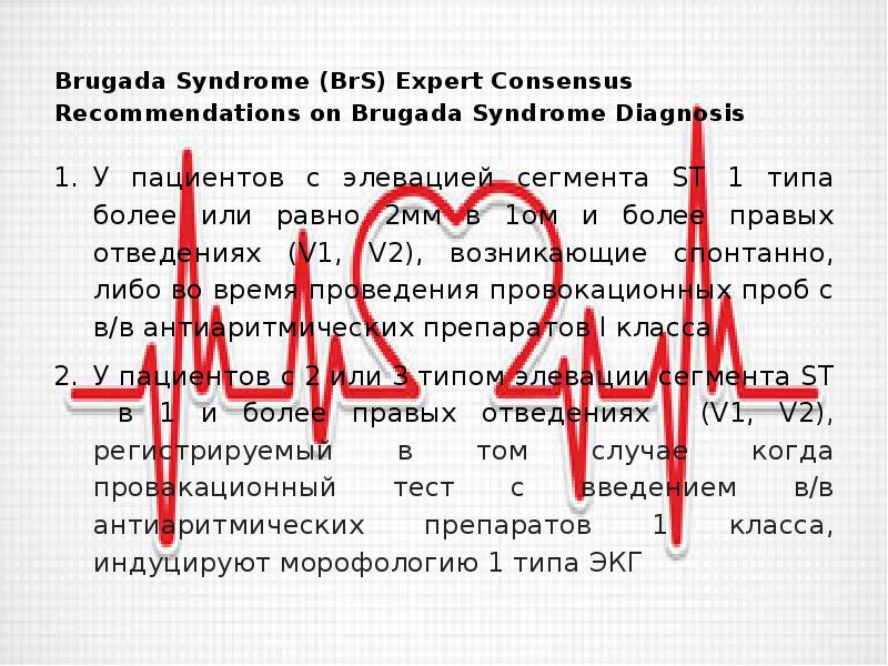 Синдром Бругада