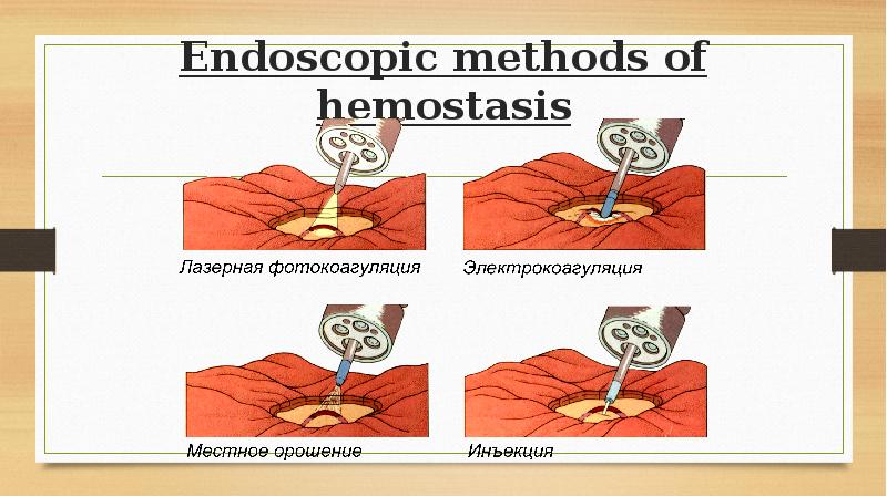 SIW “Modern methods of diagnosis and surgical treatment of acute ...