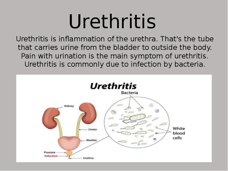 V i e w o n : P h y l o genetic d i s o rders of e x c r etory system S ...