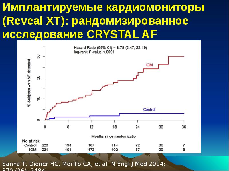 Криптогенный инсульт