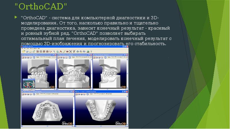 Инновационные технологии в ортодонтии