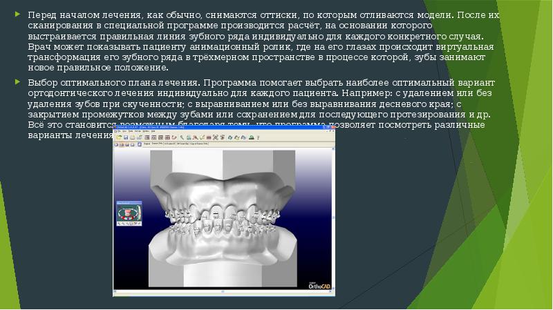 Инновационные технологии в ортодонтии
