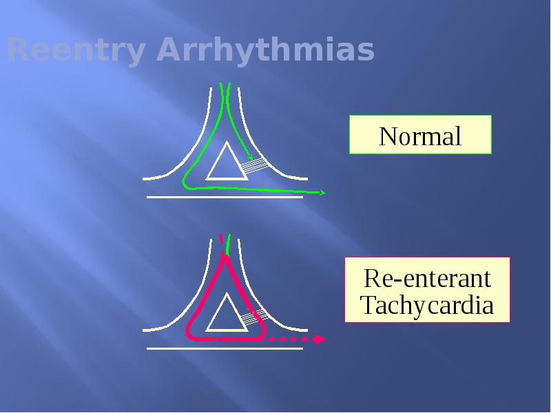 Cardiac Arrhythmias Done by: Islamova Sh. Group: 646 P. Checked by ...
