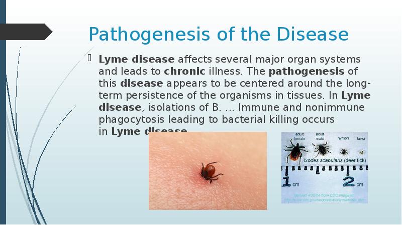 Lyme Disease