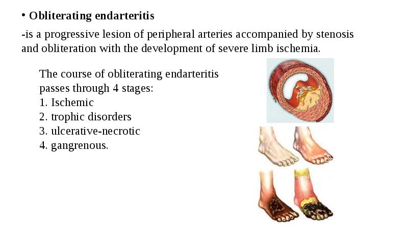 SIW “Prevention and early diagnostics of features of circulation ...