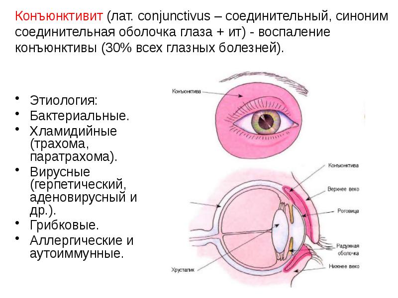 Сестринский уход при заболеваниях век и конъюнктивы