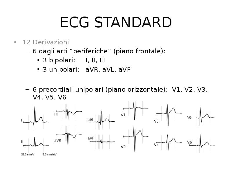 ELETTROCARDIOGRAMMA PARAMETRI VITALI
